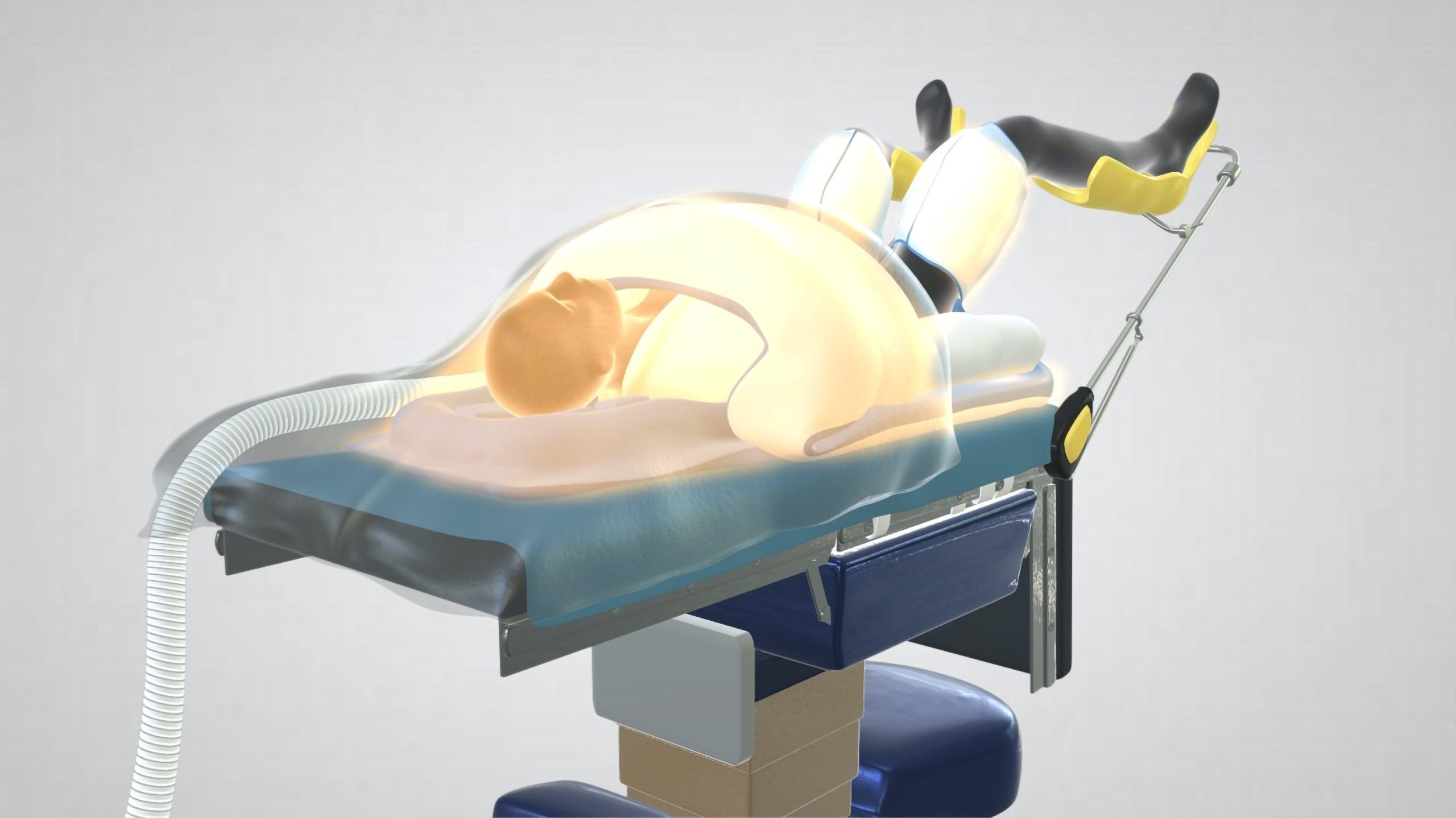 ANESTHESIA / AIRWAY MANAGEMENT Summary | SourceMark Medical